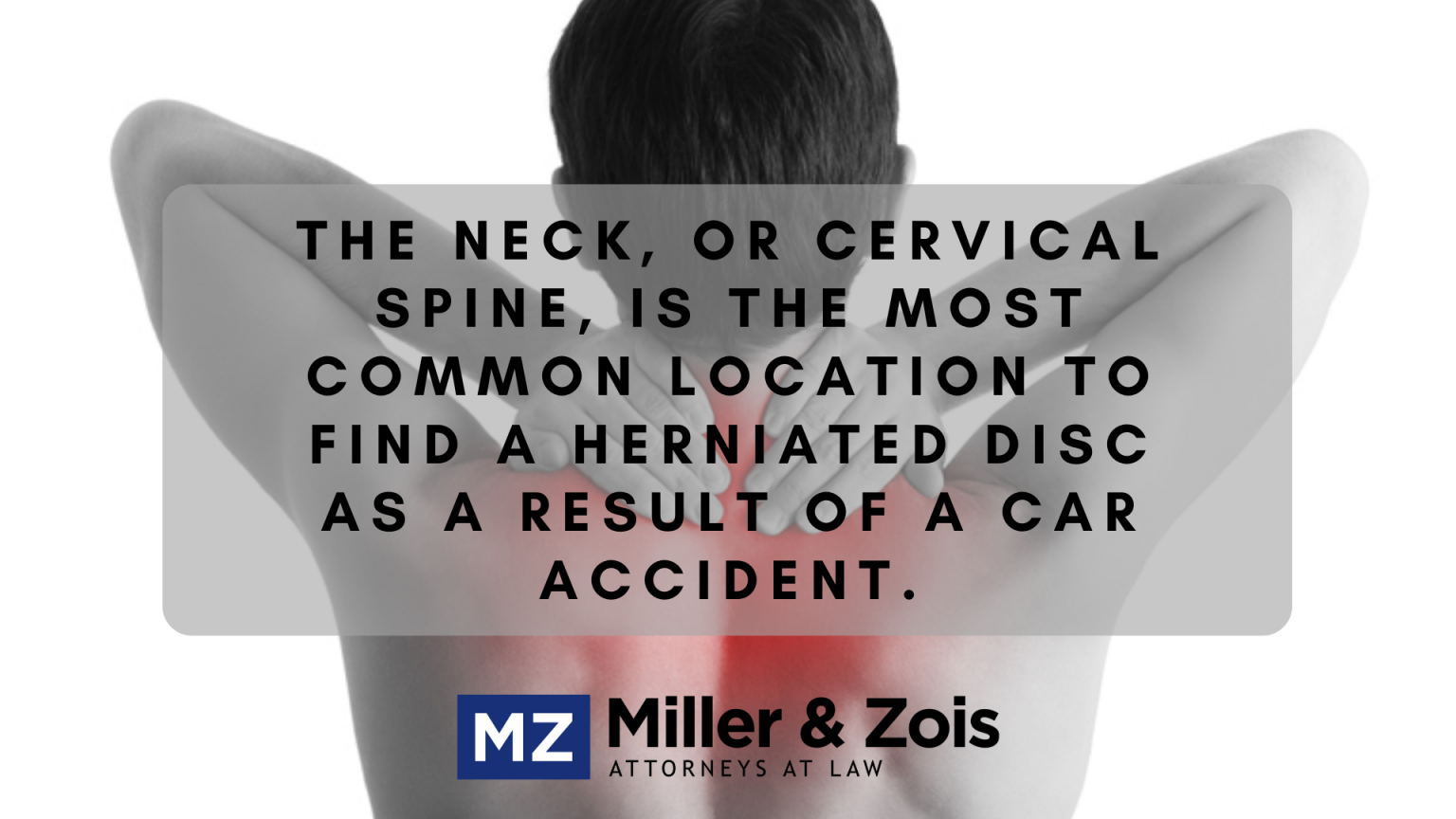 Back Injuries from Car Accident | What to Expect