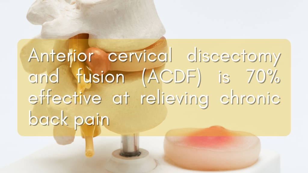 ACDF: Spinal Fusion Car Accident Claims — Baltimore Injury Lawyer Blog