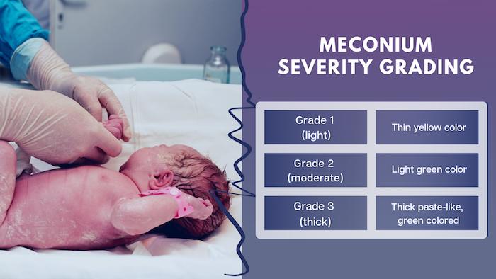 Meconium Aspiration Birth Injury Lawsuits | Malpractice Lawyers